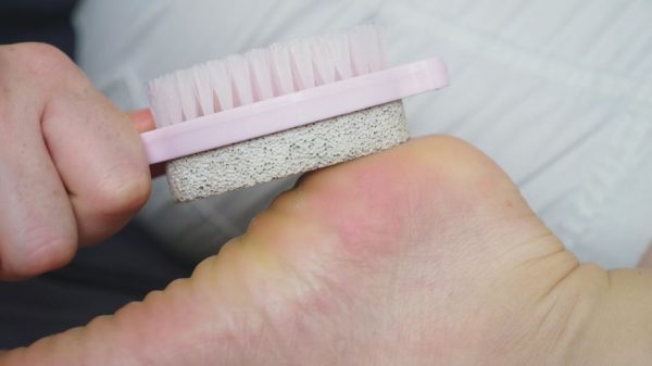 How To Remove Calluses Naturally From Hands + Feet | Power Life